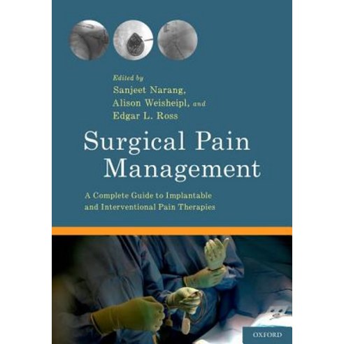 Surgical Pain Management: A Complete Guide to Implantable and ...