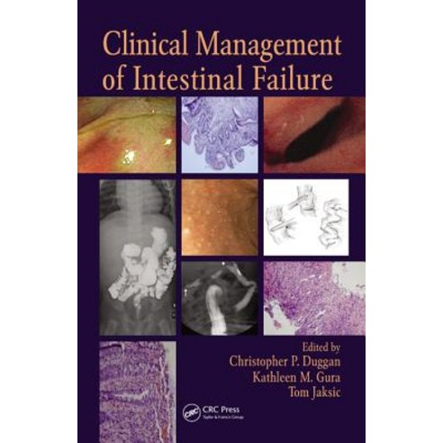 Clinical Management of Intestinal Failure Hardcover, CRC Press - 가격 변동 ...